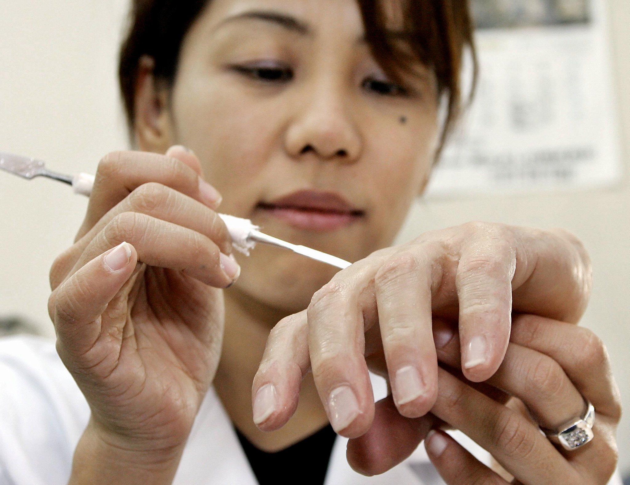 Visão | Ela faz dedos falsos para gangsters reformados