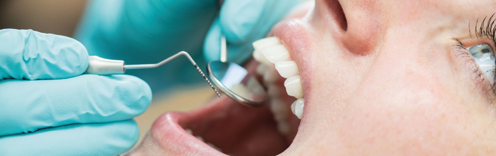 Visão | A importância do microbioma oral: Como as bactérias da boca ...